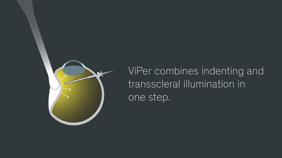 Illumination | Ophthalmology | OS 4