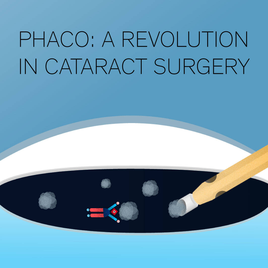 Oertli Blog | Ophthalmology & Chill