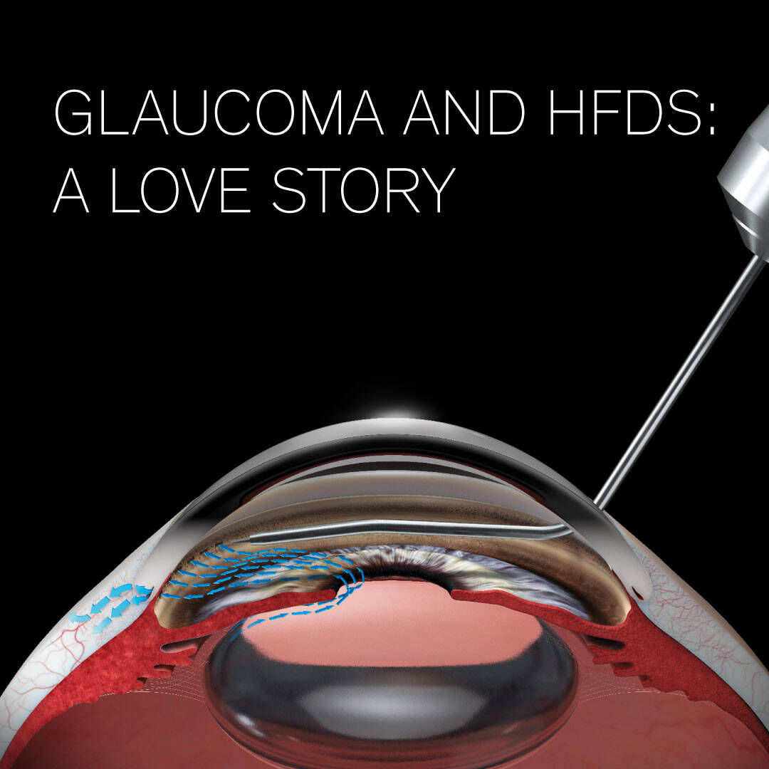 Oertli Blog | Ophthalmology & Chill