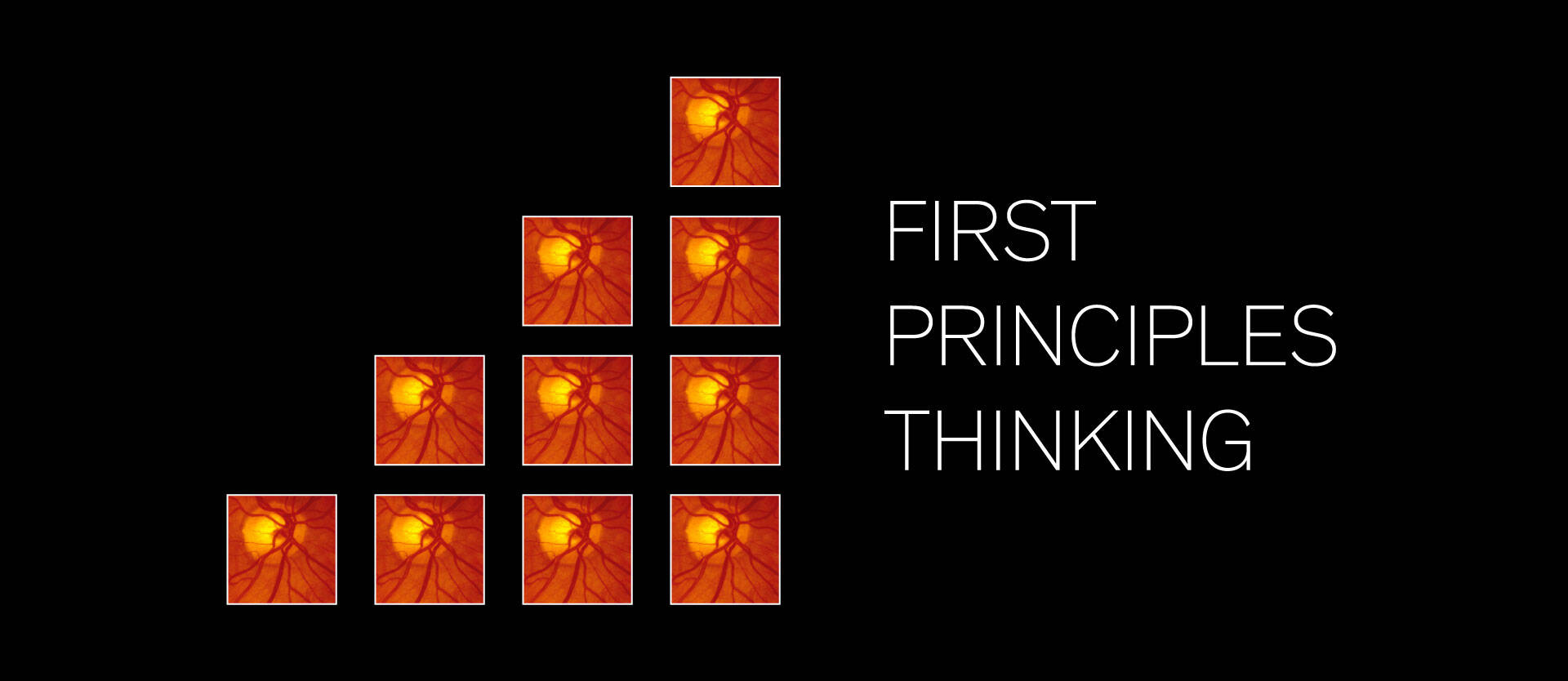 Oertli Blog | First-Principle thinking in retinal surgery