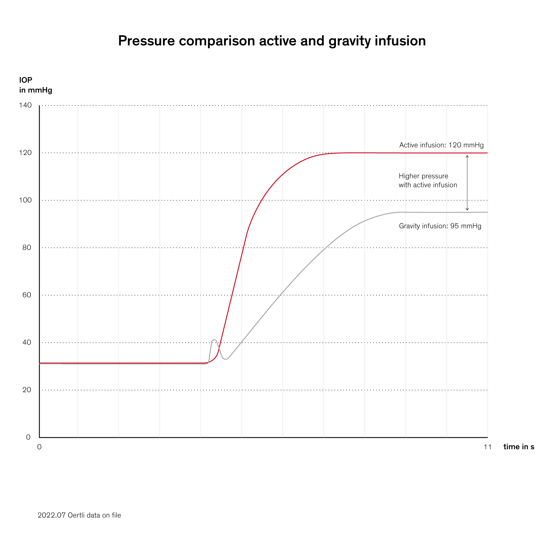 Infusion system | OS 4 | Oertli Instrumente AG