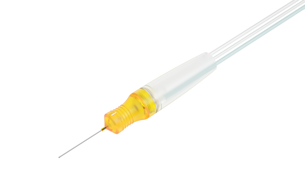 Anterior Vitrectomy | Ophthalmology | Faros