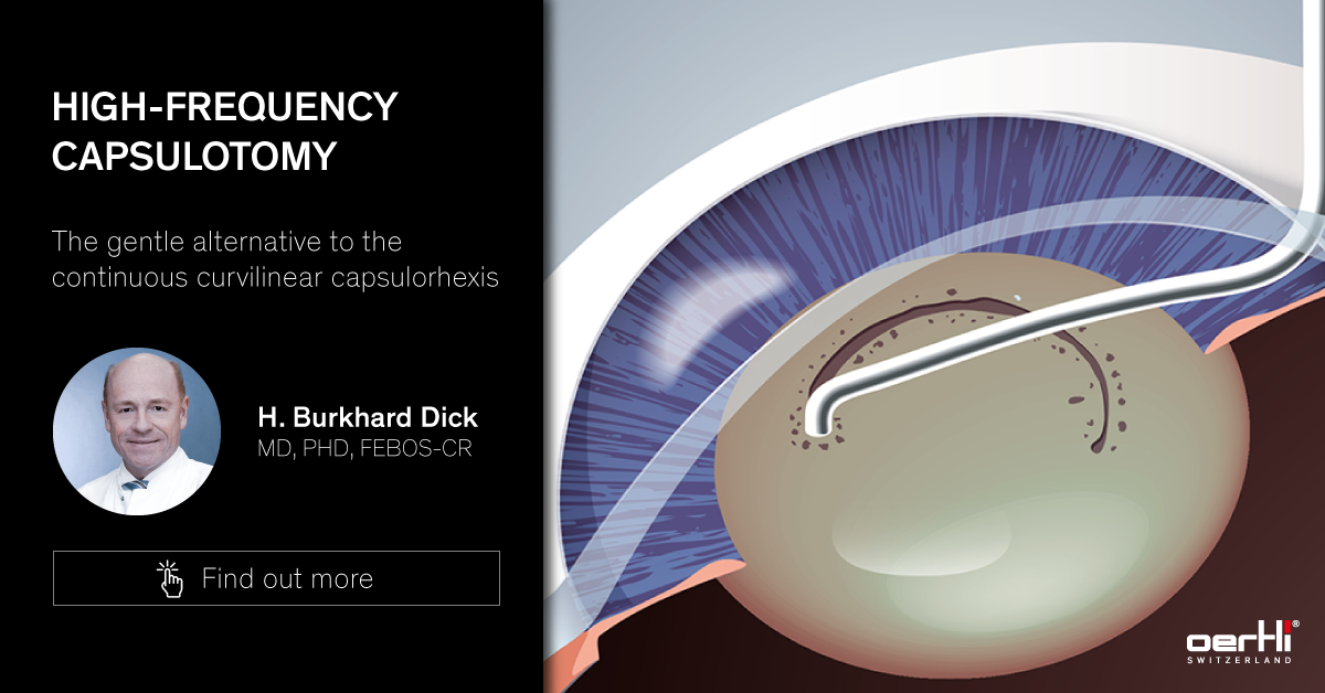 High-Frequency Capsulotomy technology