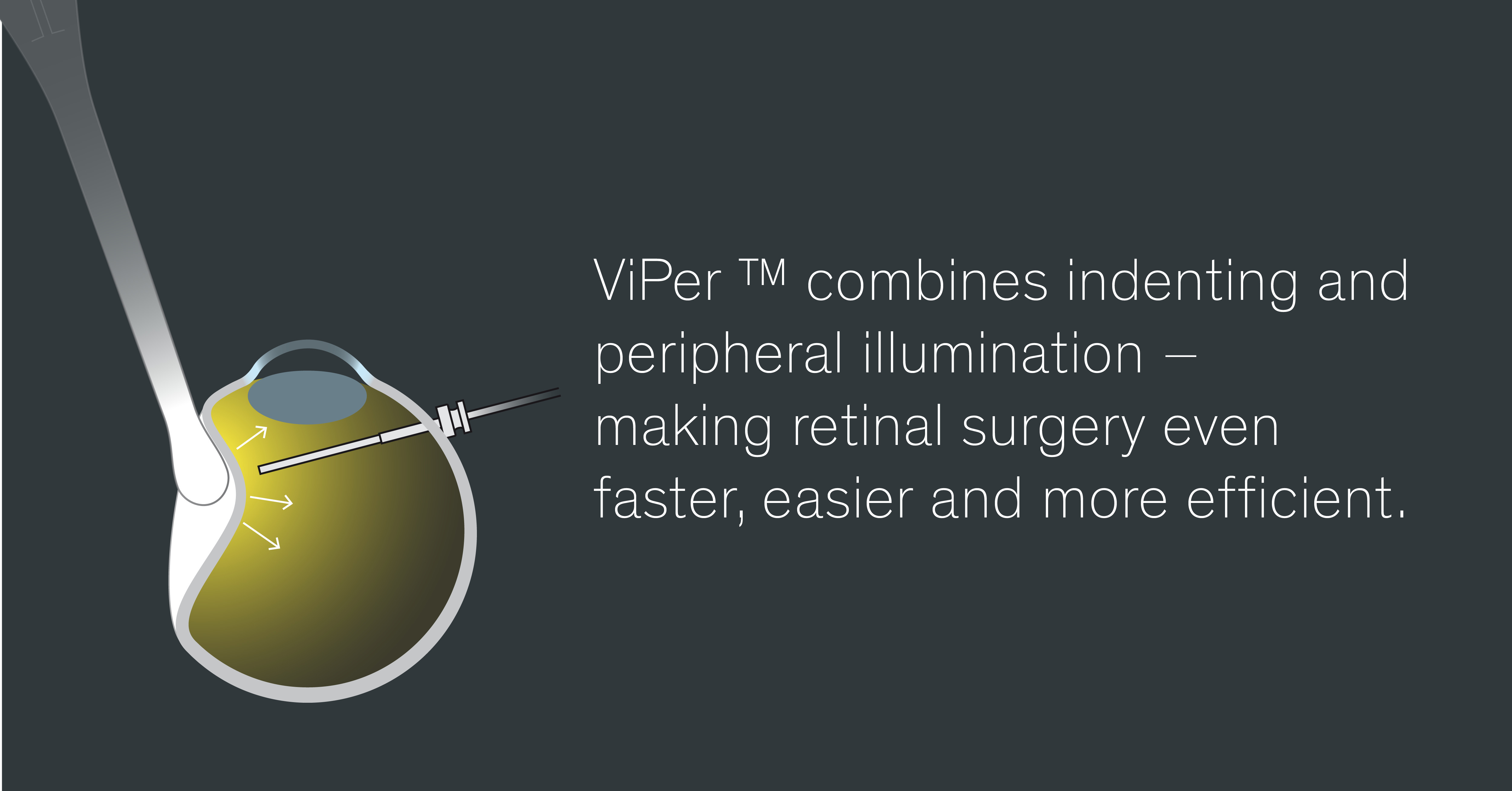 Illumination | Ophthalmology | OS 4